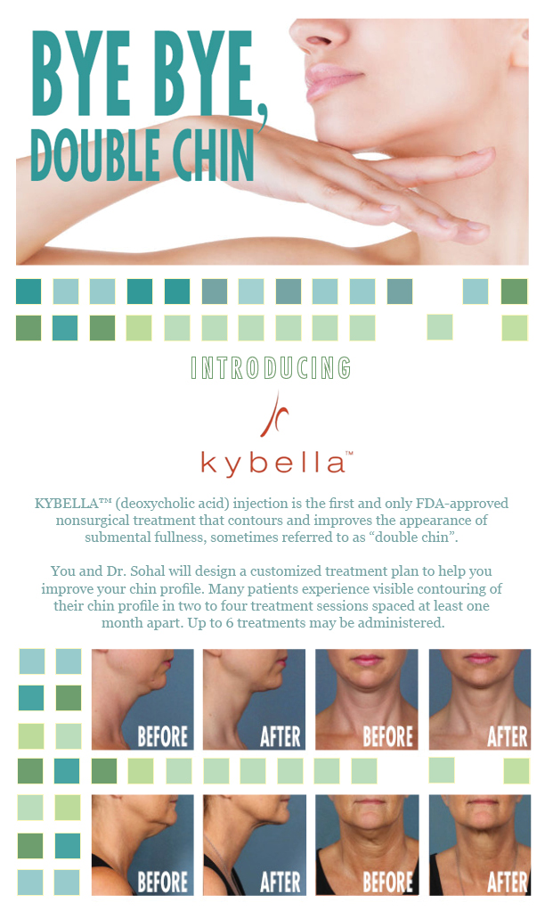 Balle Bliss Introduces Kybella